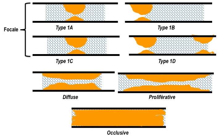 Quelques définitions - Cardio paramed : Cardio paramed
