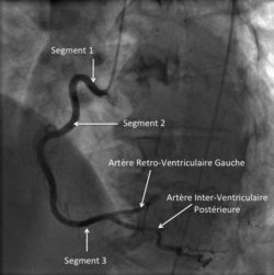 Anatomie - Cardio paramed : Cardio paramed