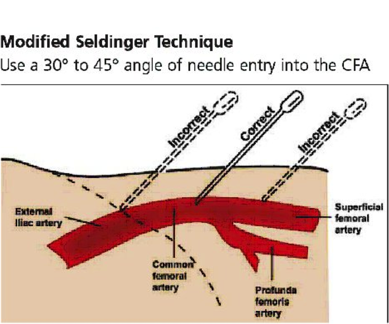 Le déroulement de l'examen - Cardio paramed : Cardio paramed