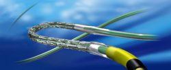 Le stenting - Cardio paramed : Cardio paramed
